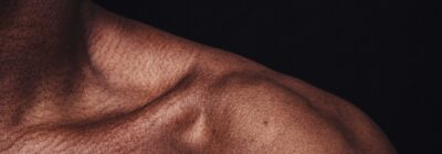 Lesión de SLAP de Hombro: Síntomas y Tratamiento | Artrocare